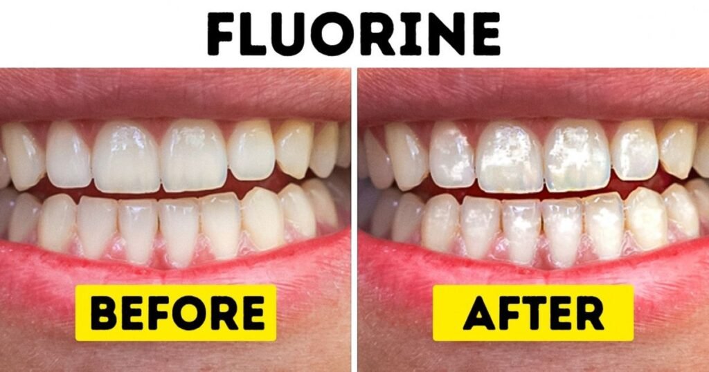 The Top 7 Foods That Severely Harm Your Teeth – HealthW