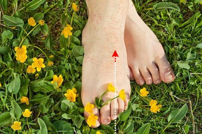 6 Leg Health Problems That Can Signal Serious Illnesses – HealthW