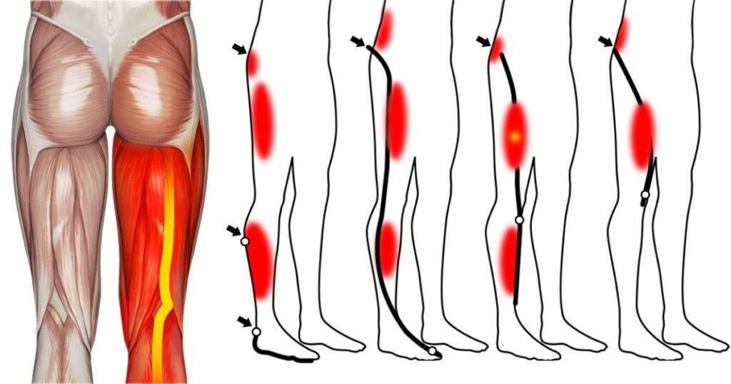 6 Simple Exercises That Relieve Leg Pain in the Blink of an Eye – HealthW