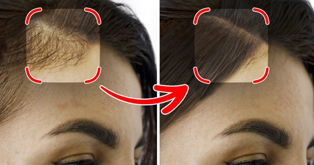 How To Make Your Hair Grow Faster: 6 Natural Hair Growth Tips – HealthW